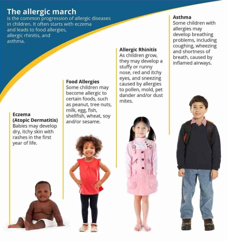 What is the Allergic March? - Allergy & Asthma Network