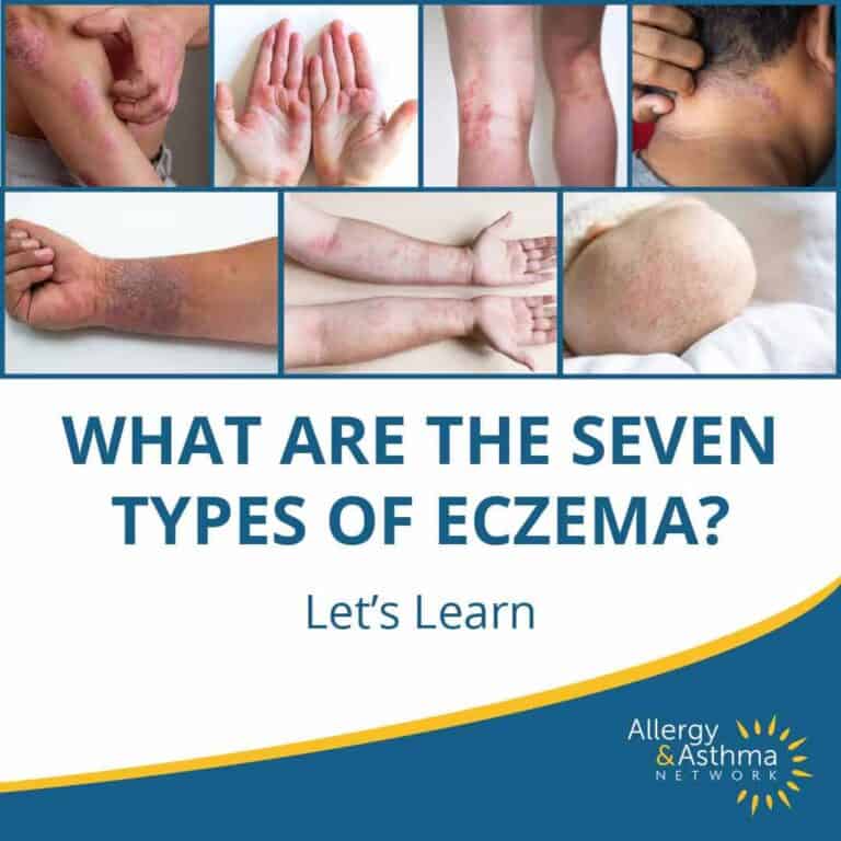 Eczema Resources for Patients - Allergy & Asthma Network
