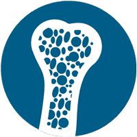 What to Consider to Minimize OCS Side Effects | Allergy & Asthma ...